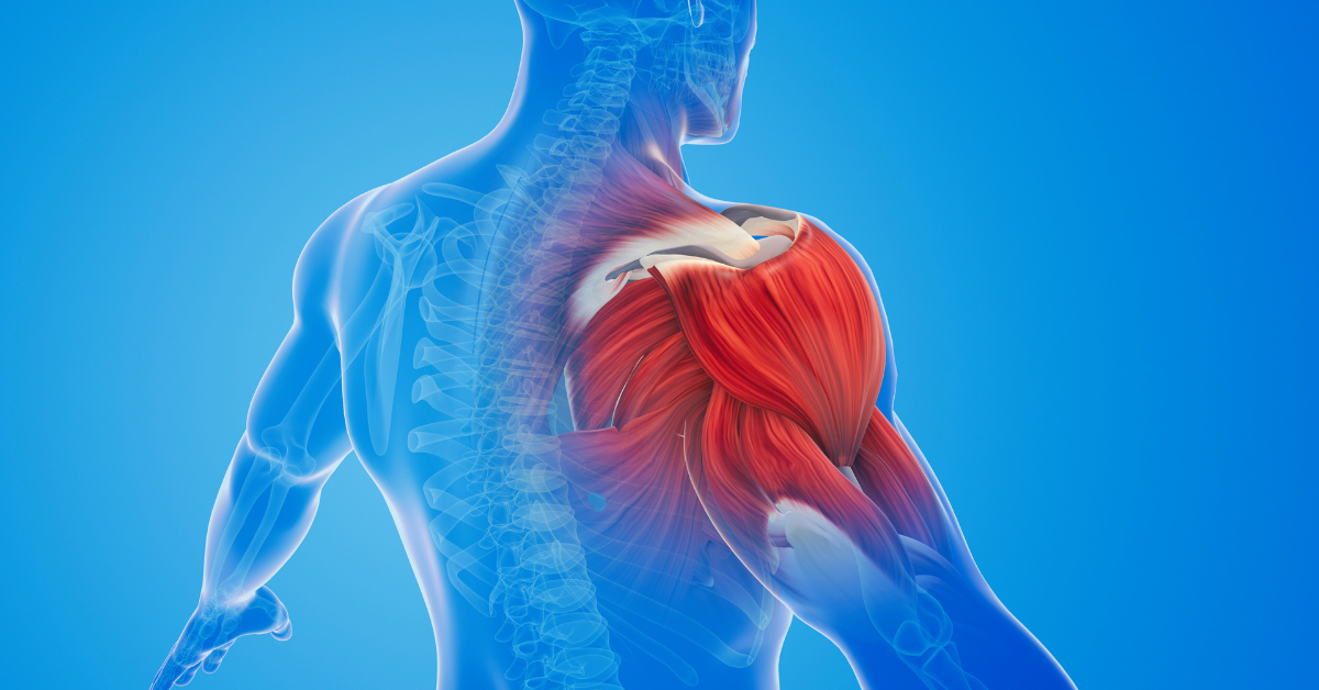 Debunking Myths: Why soft-tissue injuries need a soft-tissue injury ...